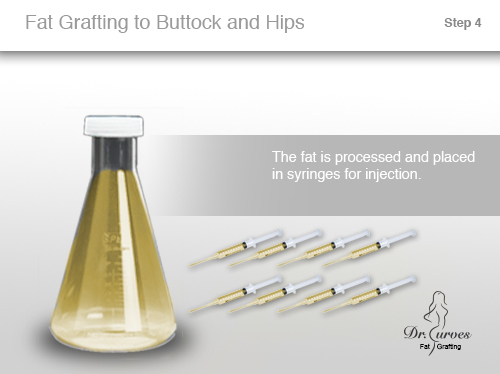 Contact Us - Dr Curves